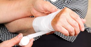 Gebrochenes Handgelenk: Symptome, Ursachen, Risikofaktoren & Behandlung ...