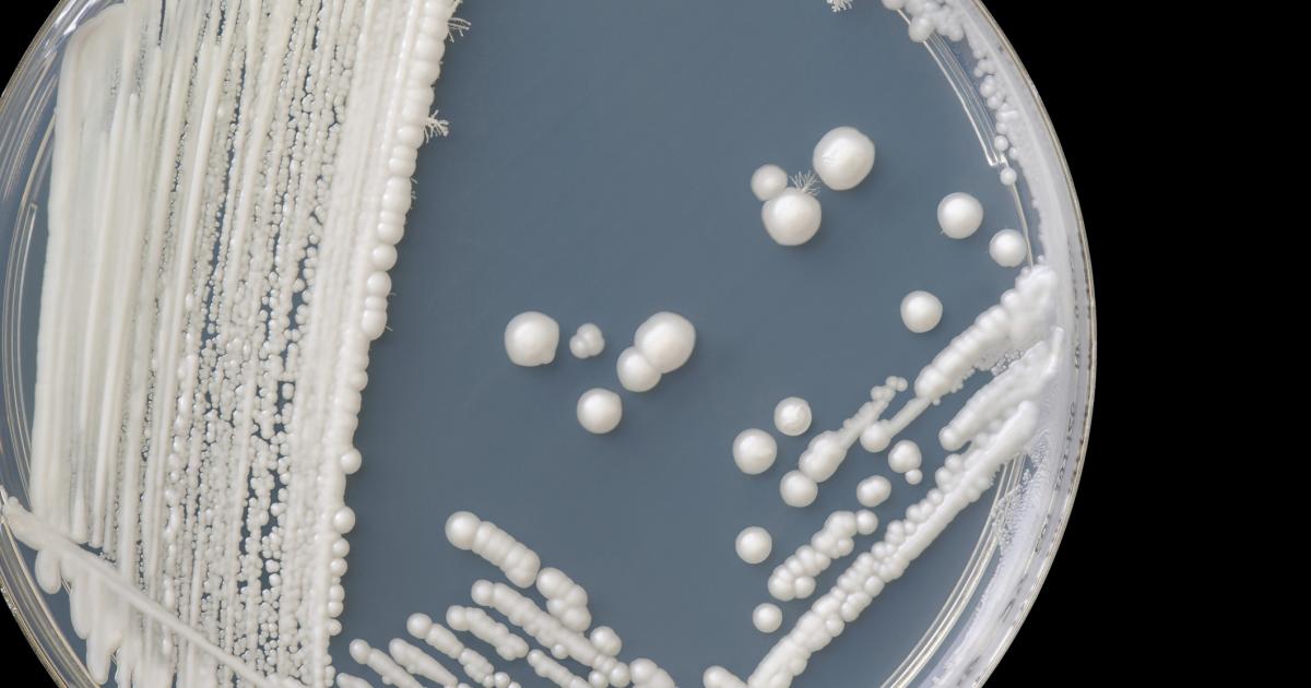 Candida - Symptome, Ursachen, Behandlungen - Dr.med.Julia.com