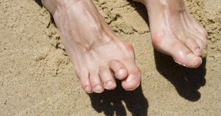 Toe Pain - Schmerzen in den Zehen - Symptome, Ursachen, Behandlungen ...